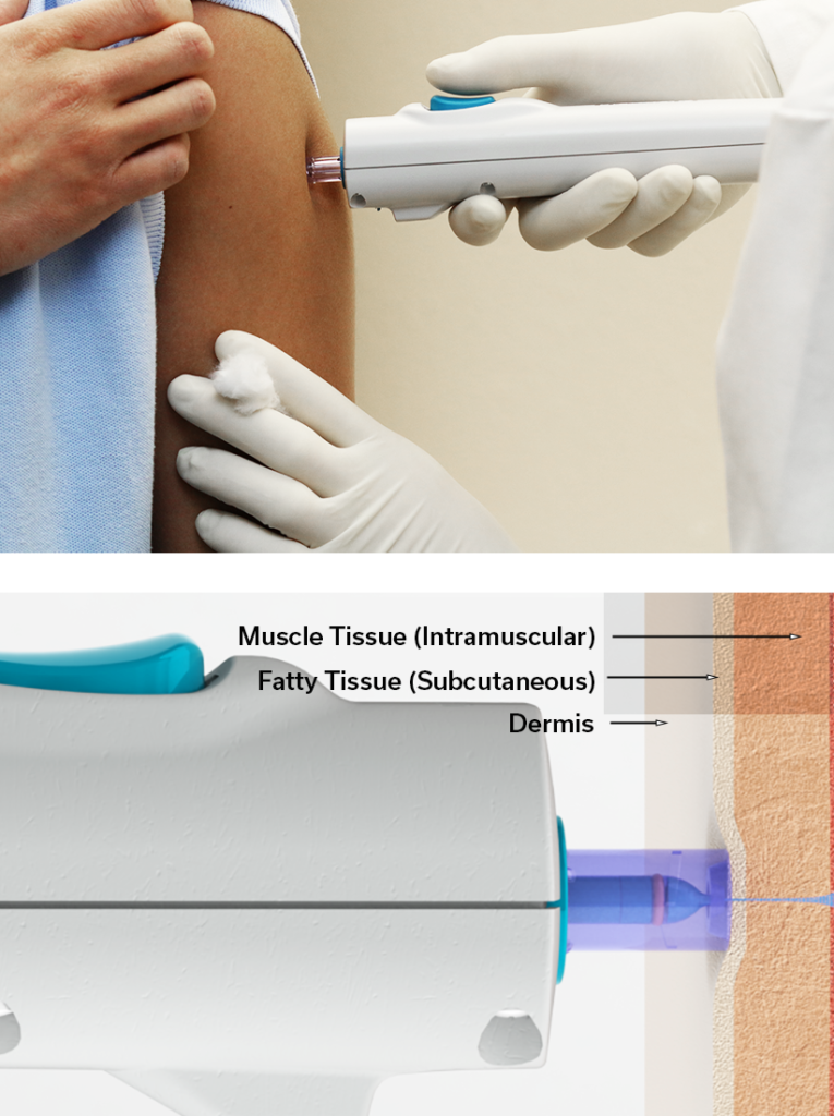 Needle-free Injection Technology - PharmaJet