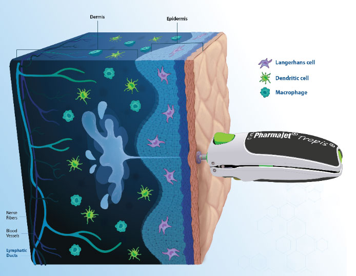 Unlocking the Full Potential of Immunization: The Case for Intradermal ...